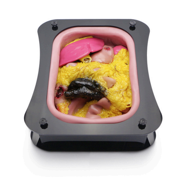 Anatomical Simulator for Abdominal Viscera - Pro Delphus